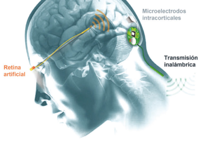 Método CORTIVIS para prótesis visuales intracorticales https://t.co ...